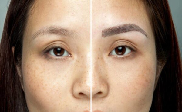 How do eyebrows grow back quickly?