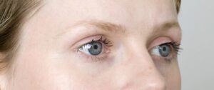 Why itchy eyebrows: causes and treatment