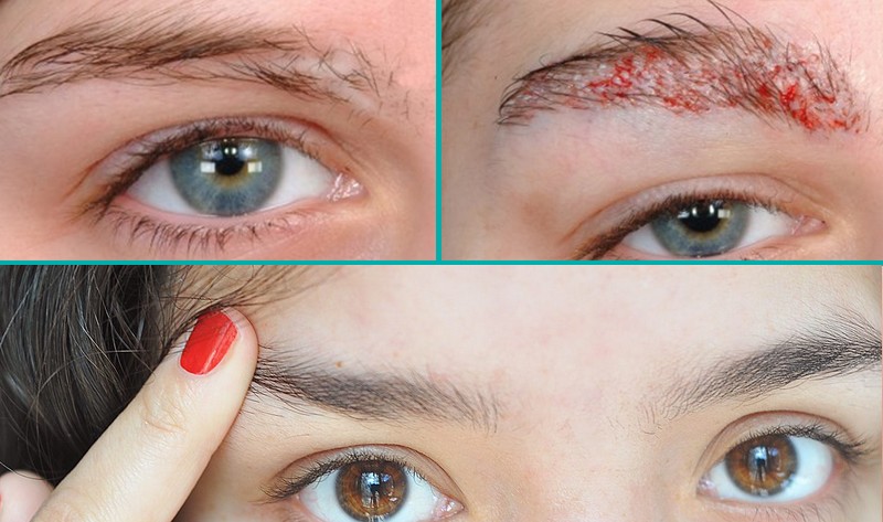 Why itchy eyebrows: causes and treatment