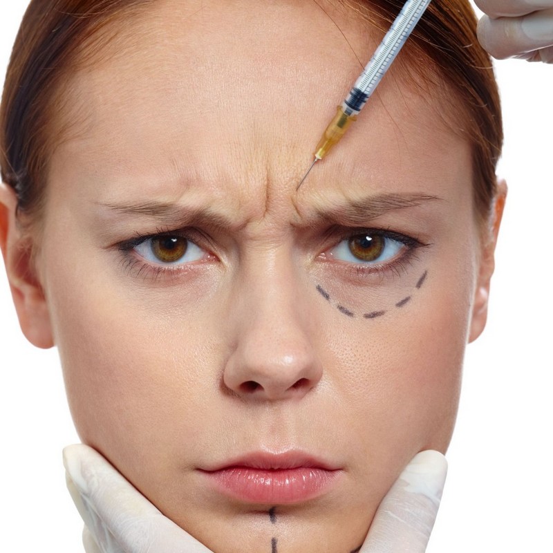 Find out more about the brow lift with botox