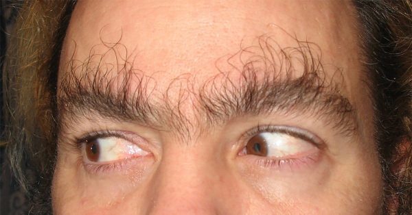 What causes random long eyebrow hair?