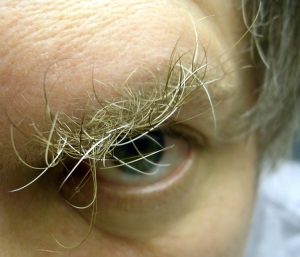 What causes random long eyebrow hair?