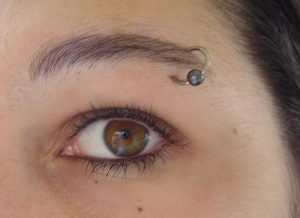 Eyebrow piercing irritation bump