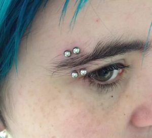 Eyebrow piercing irritation bump