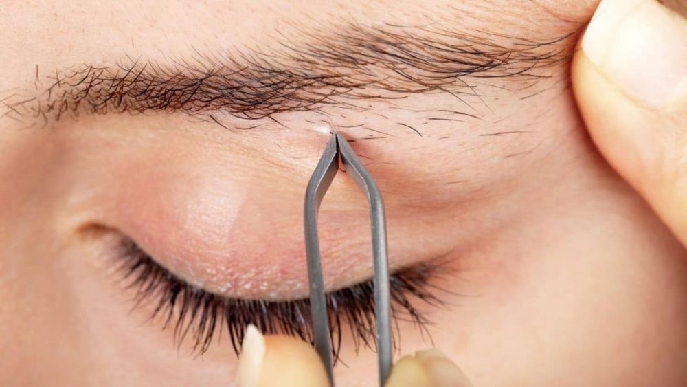 How to Get Rid of Ingrown Eyebrow Hair: The Complete Expert Guide